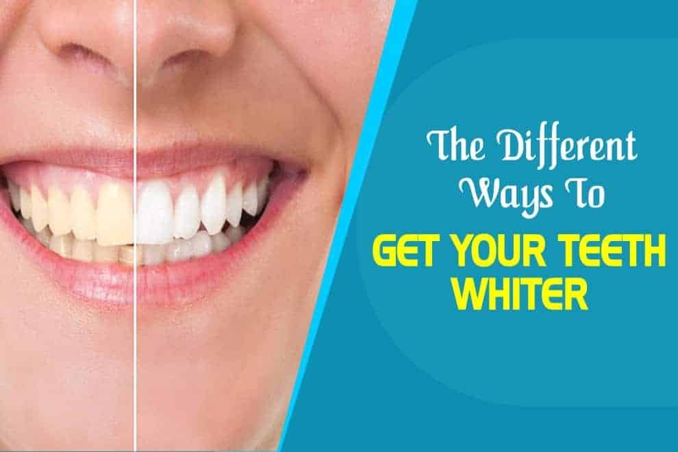The Different Ways To Get Your Teeth Whiter